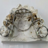 Functional Therapy | Wired Orthodontic Lab